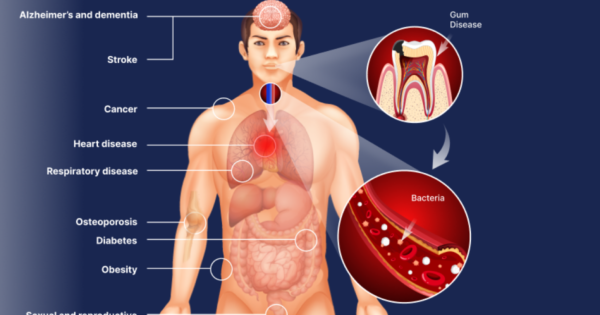 At-Home Saliva Test Kit for Oral Health Insights | Order at Dentulu™